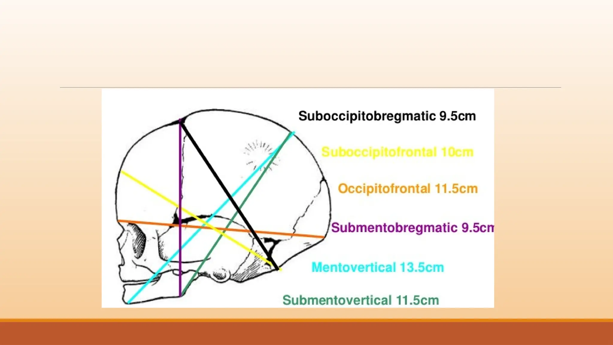 P.Fetal skull. Introduction,Region and landmark of fetal skull,bone in ...