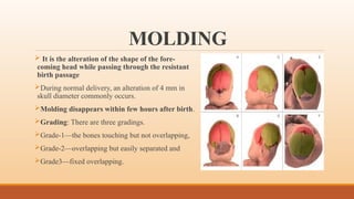 P.Fetal skull. Introduction,Region and landmark of fetal skull,bone in ...