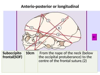 FETAL SKULL INCLUDING BONES AND DIAMETERS | PPTX