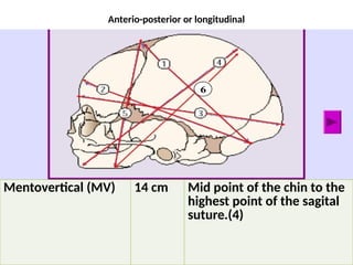 FETAL SKULL INCLUDING BONES AND DIAMETERS | PPTX