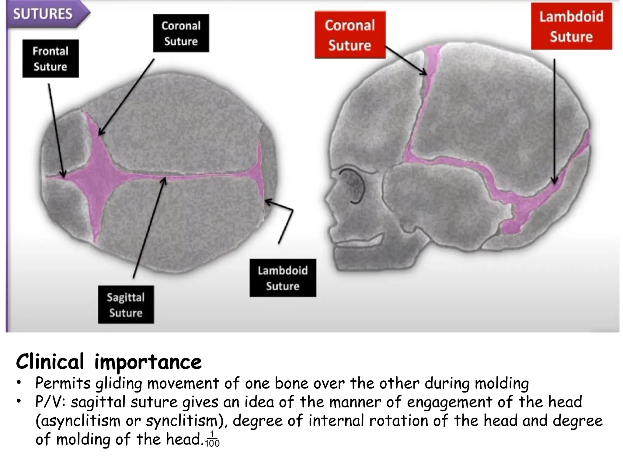 Fetal skull and it's diameters in obstetrics | PPTX