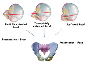 Fetal skull and it's diameters in obstetrics | PPTX
