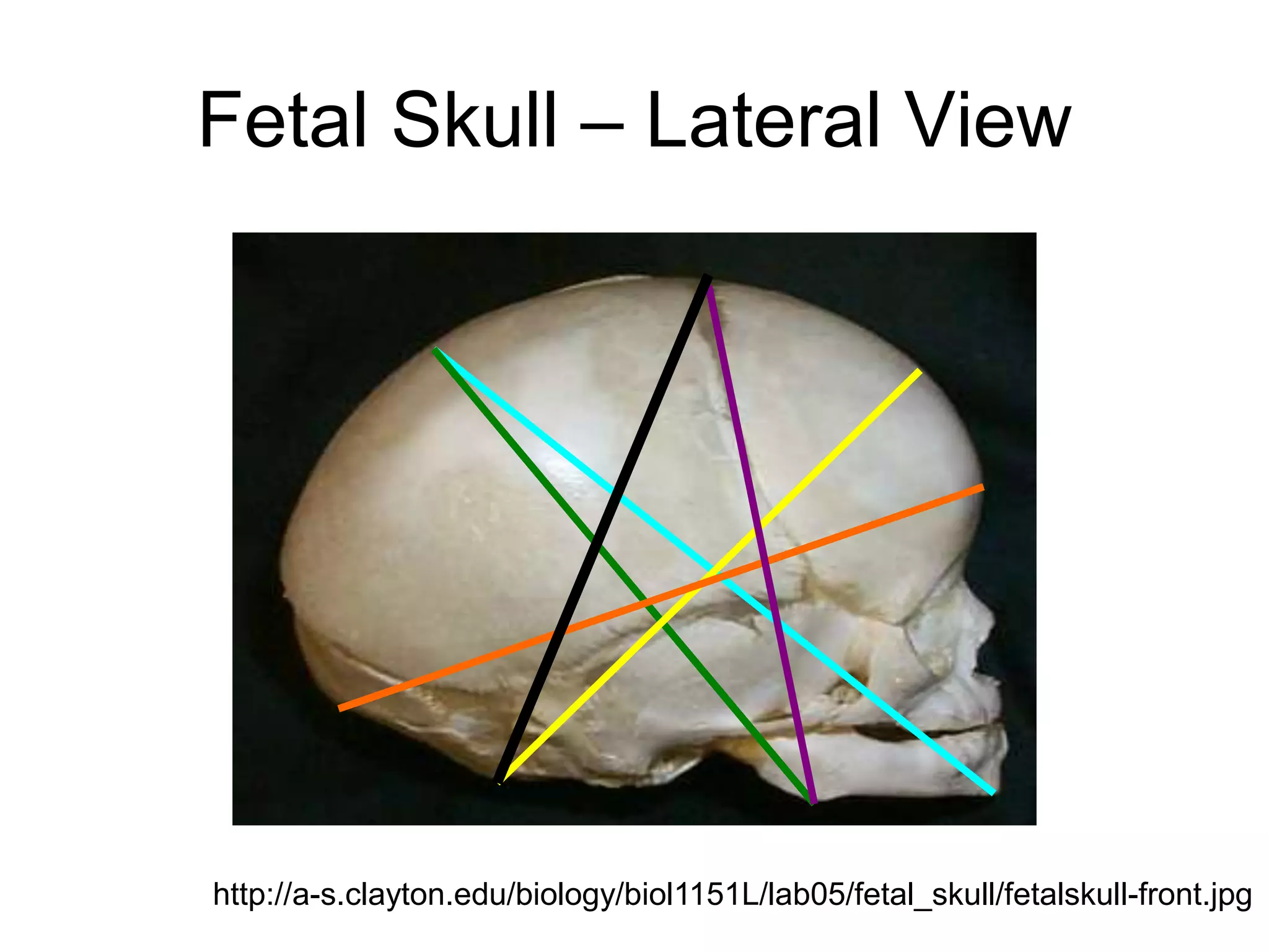 Fetal skull | PPT