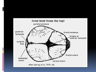 Parietal Eminence In Fetal Skull