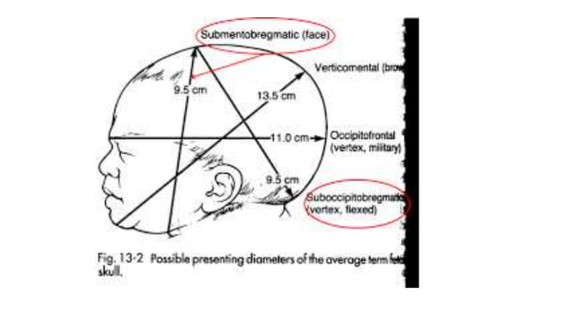 fetal skull and maternal pelvis diameters.pdf | Pregnancy ...