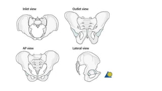 fetal skull and maternal pelvis diameters.pdf