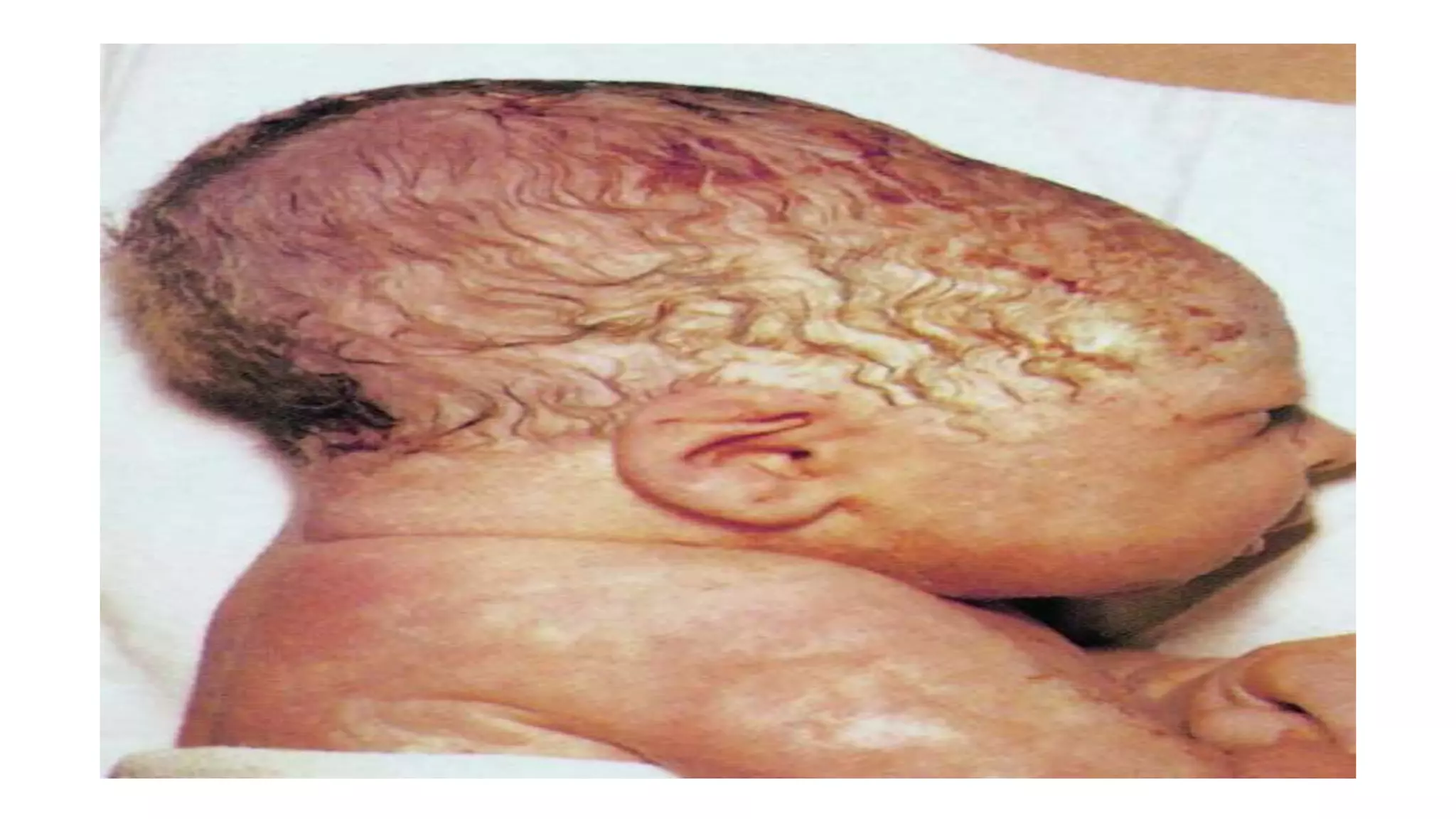 Fetal skull and maternal pelvis | PPTX