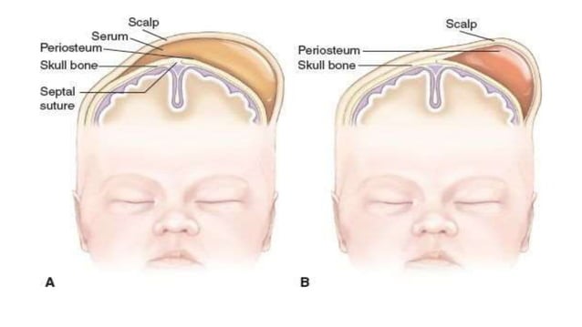 Fetal skull and maternal pelvis | PPTX