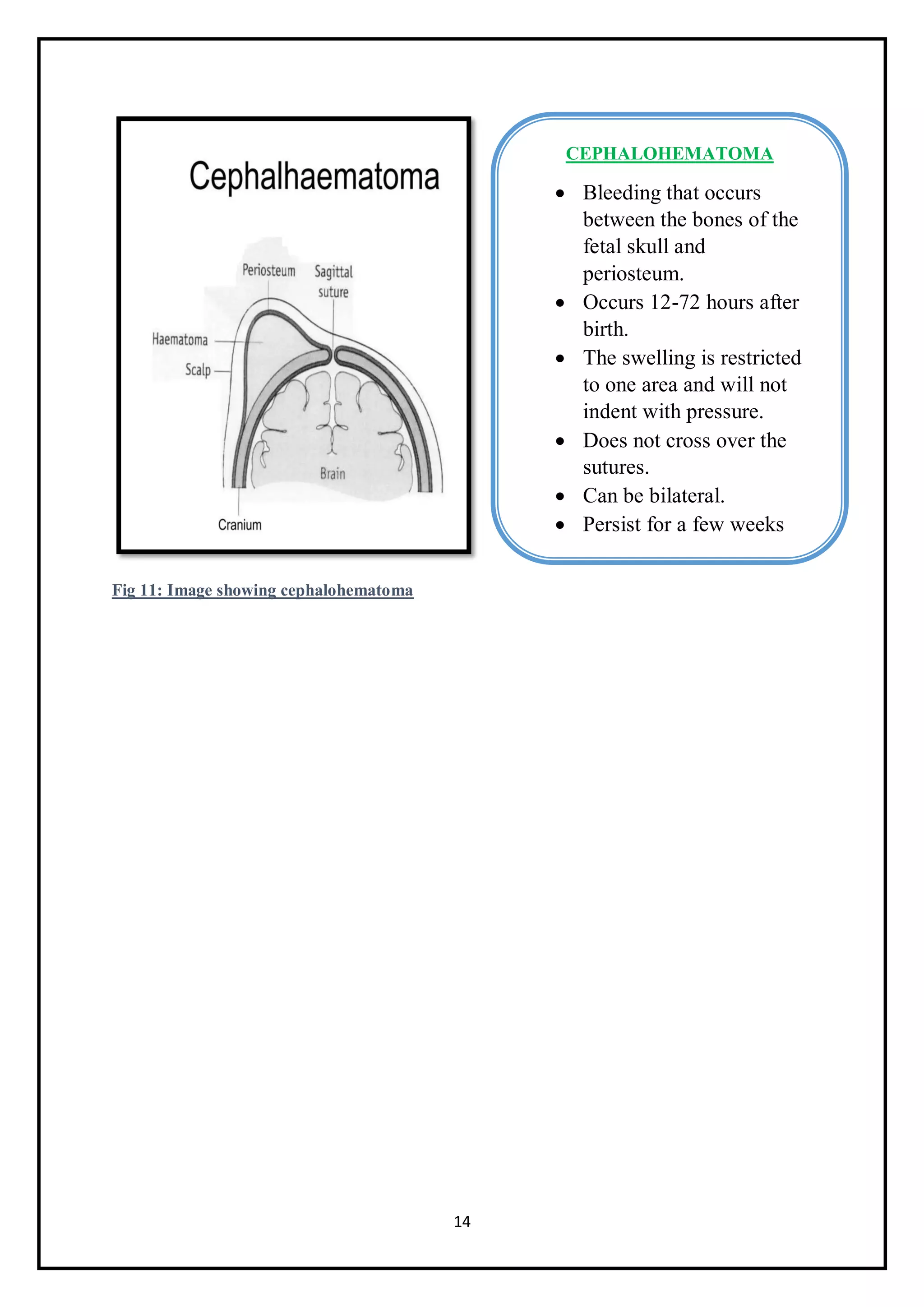 FETAL SKULL DISCUSSION (1).pdf