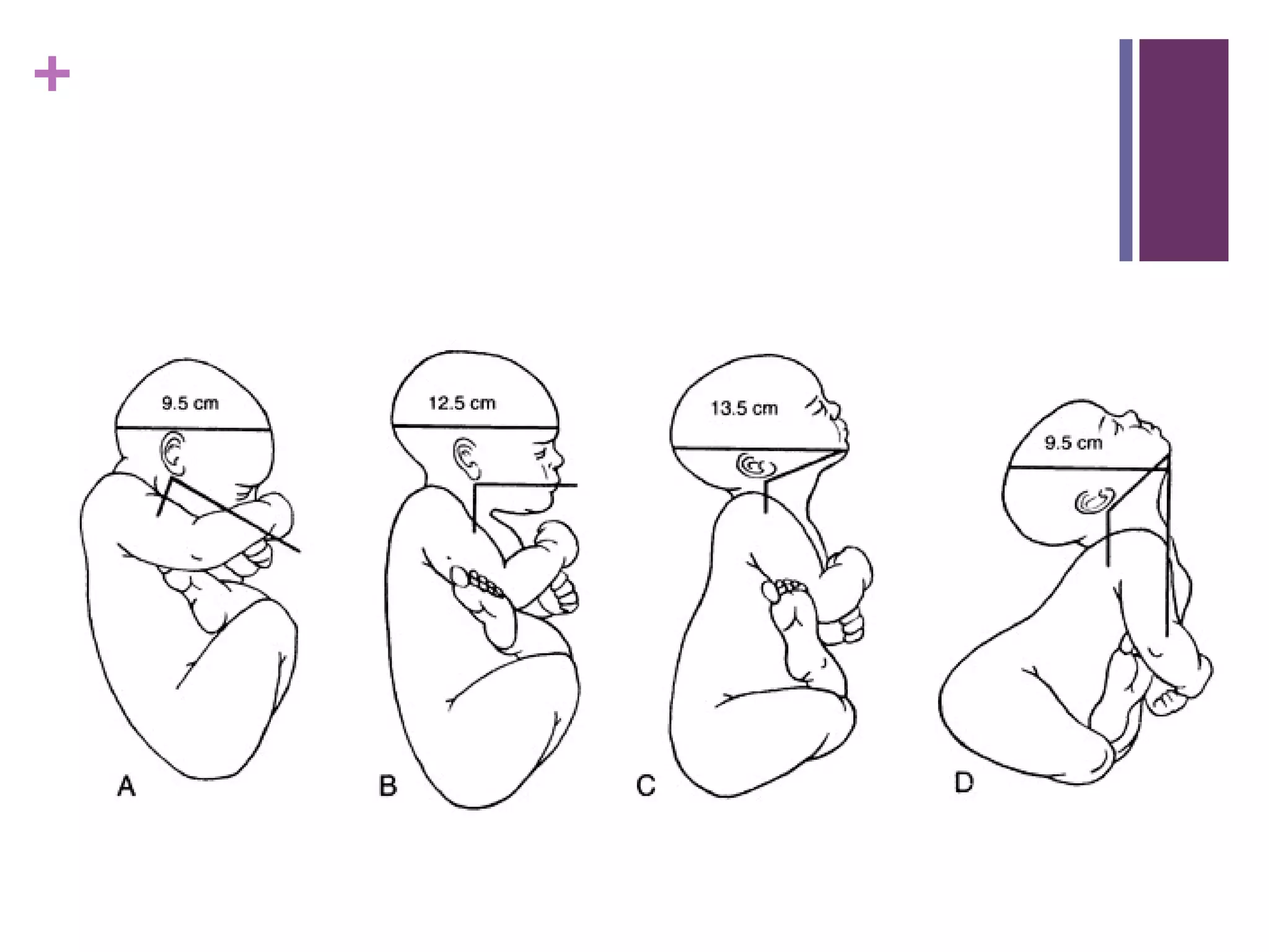 Fetal skull | PPT
