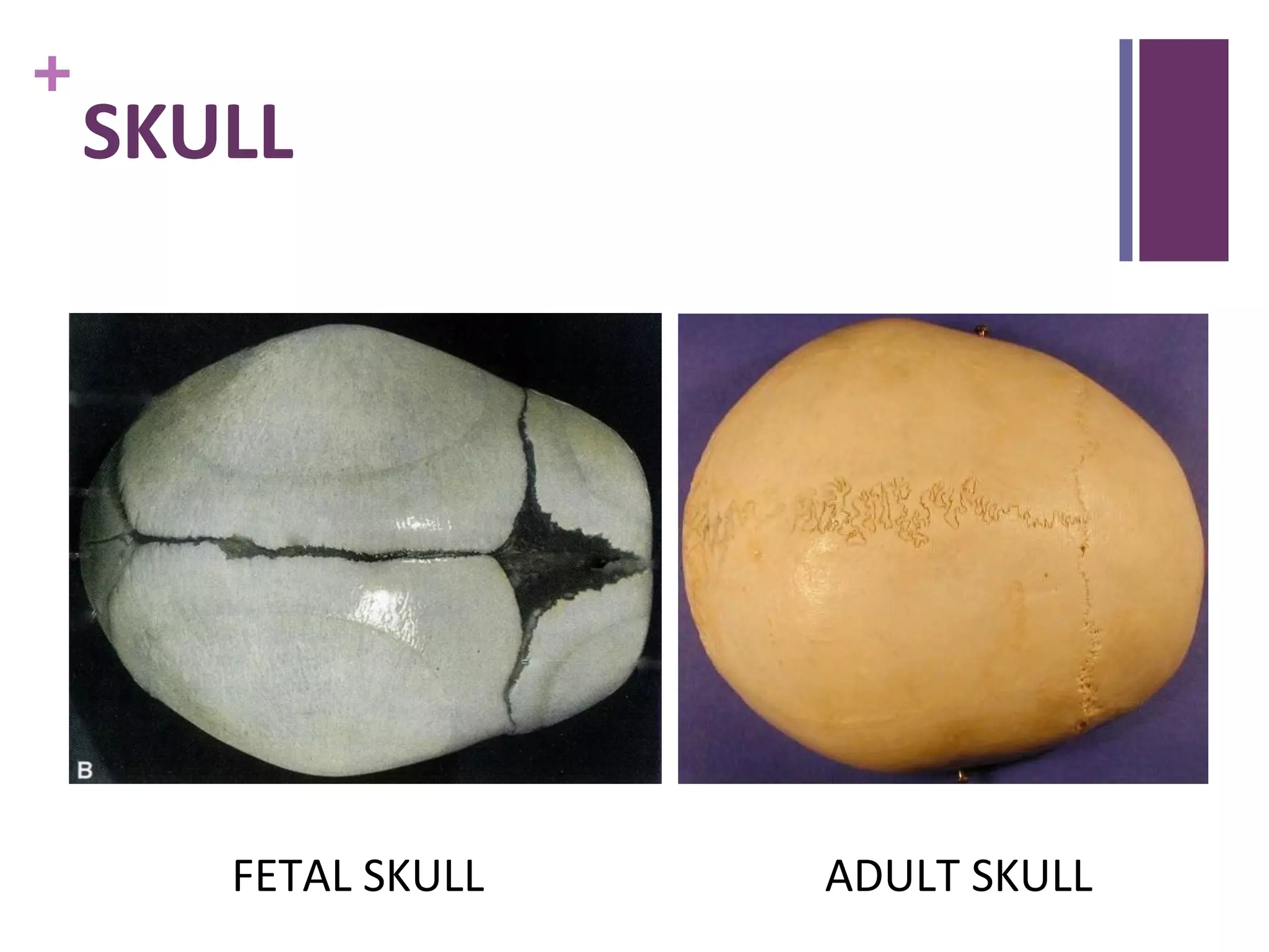 Fetal skull | PPT