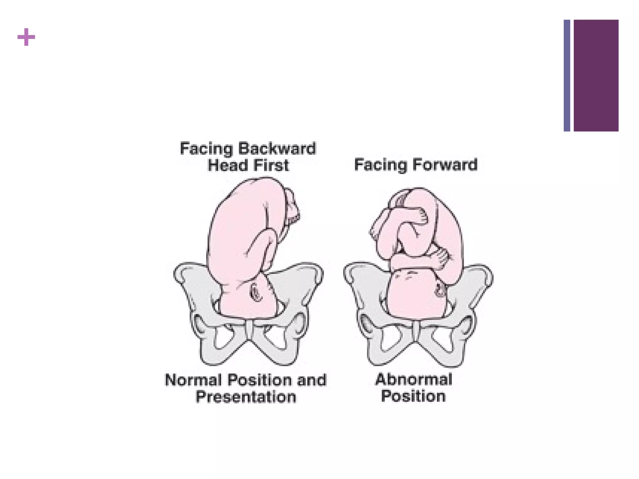 Fetal skull | PPT