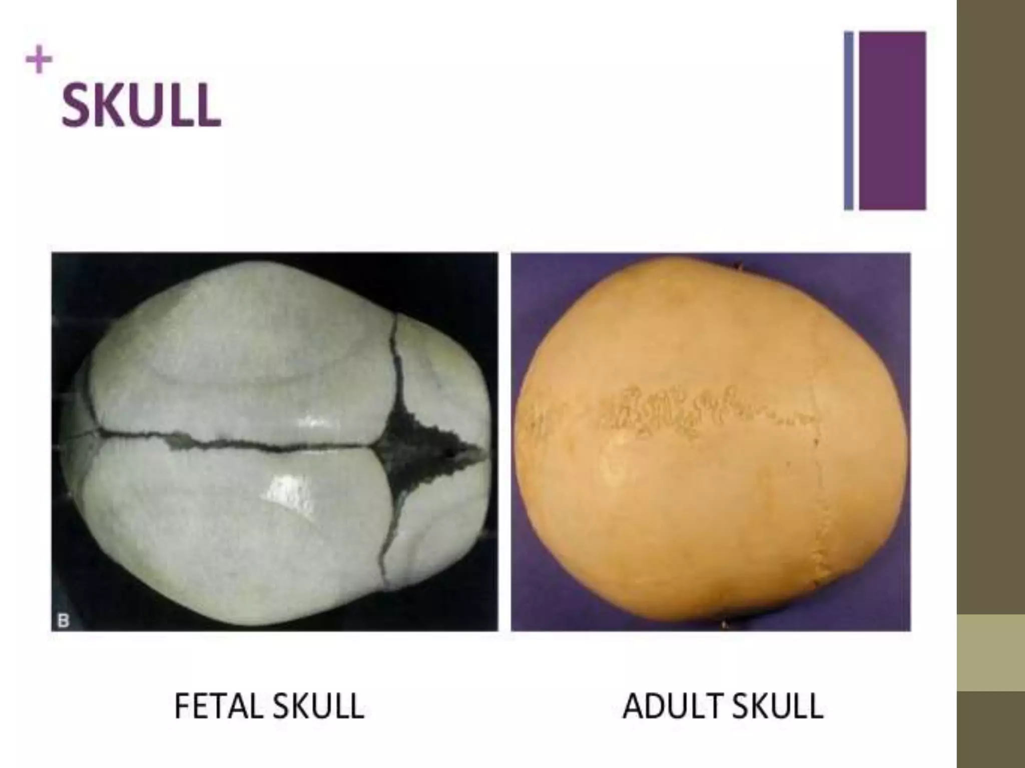 Fetal skull ppt | PPTX