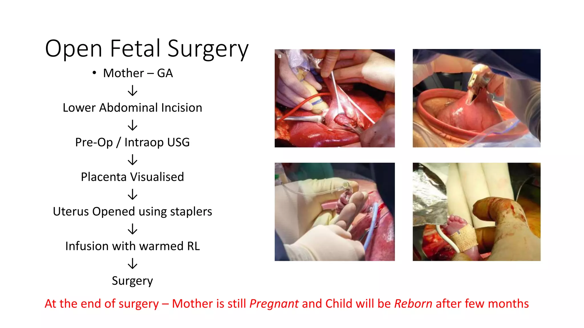 Fetal Surgery Draft.pptx