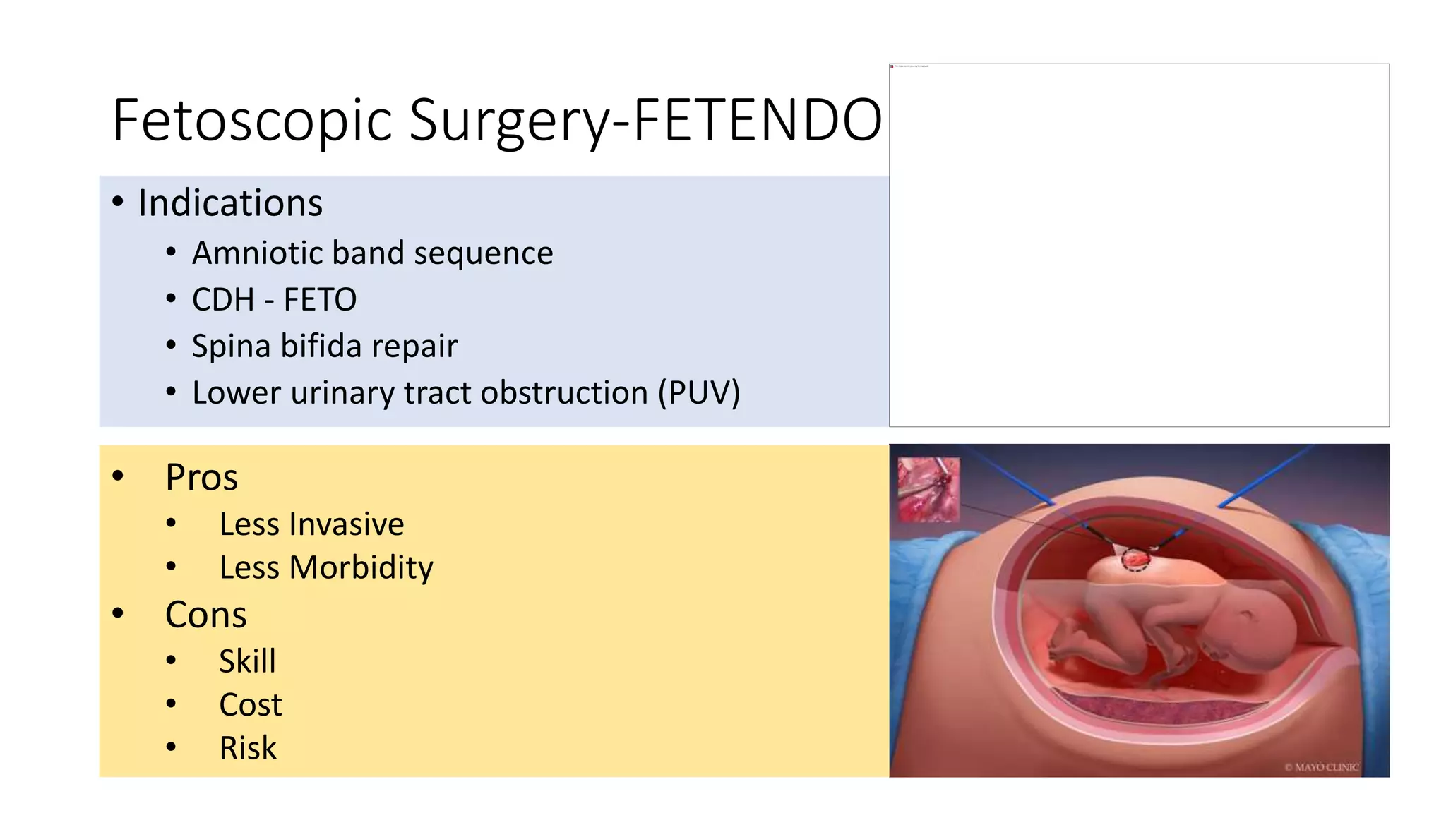 Fetal Surgery Draft.pptx