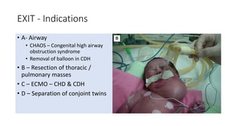 Fetal Surgery Draft.pptx