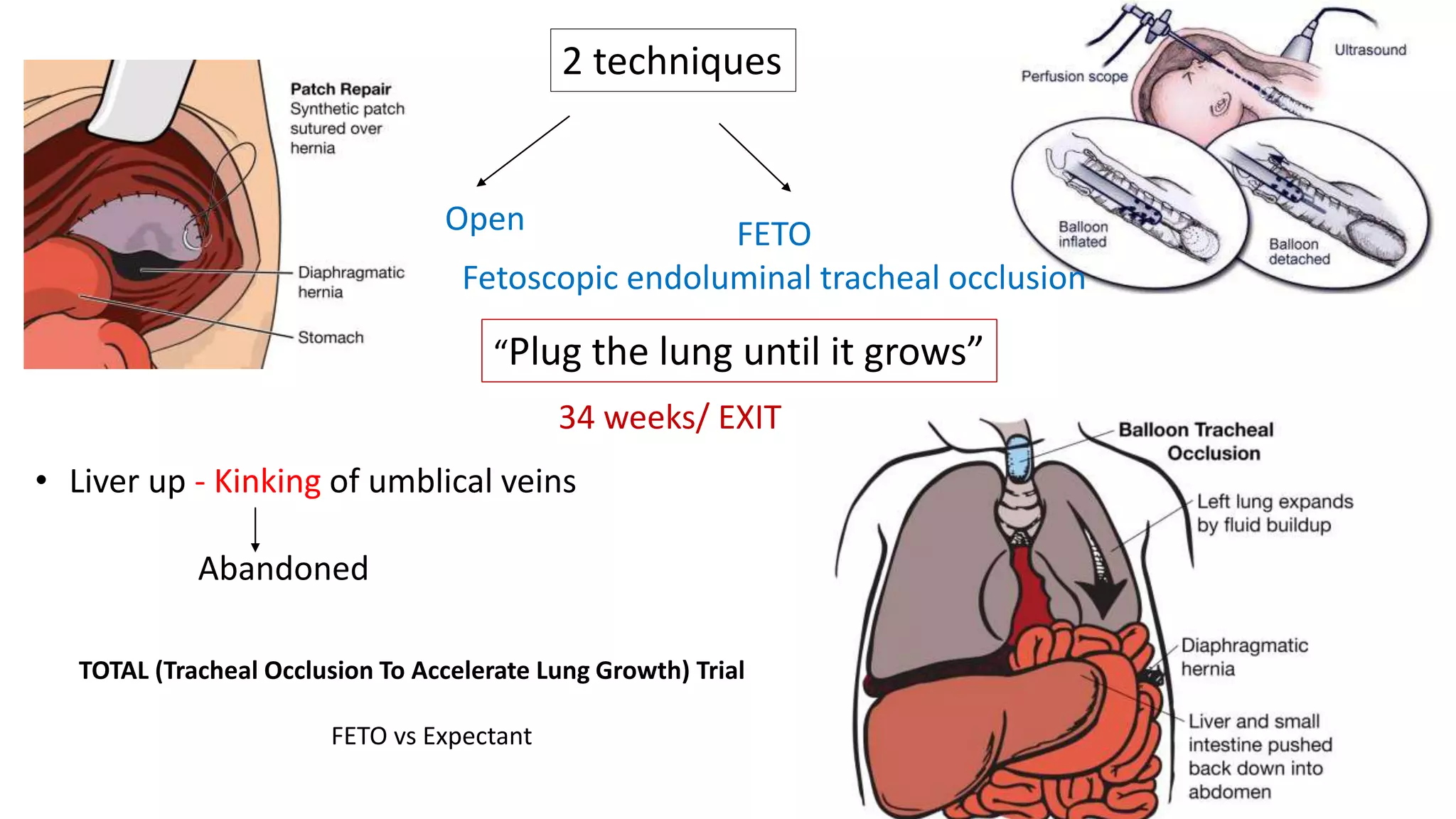 Fetal or Prenatal Surgery | PPTX