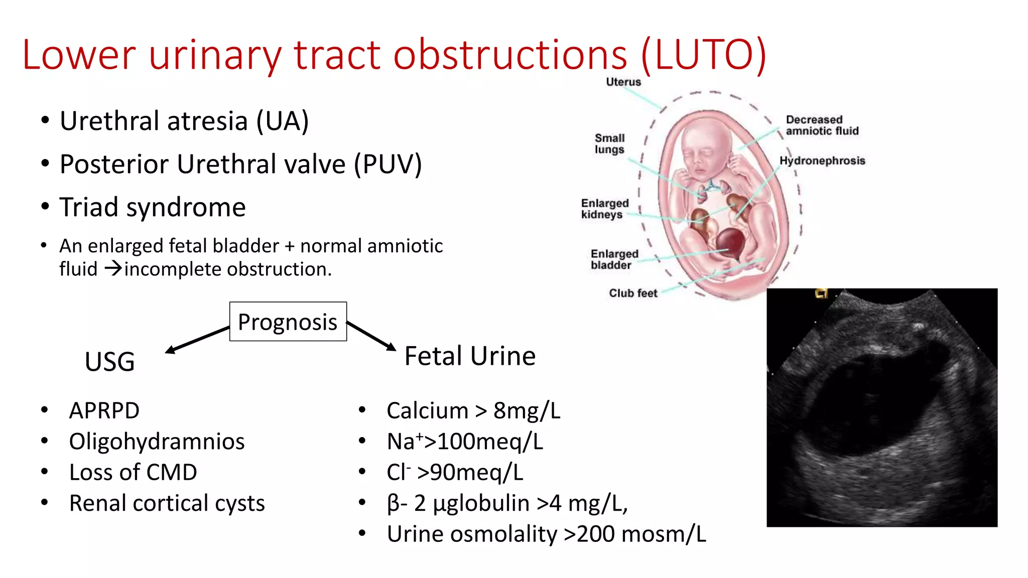 Fetal or Prenatal Surgery | PPTX