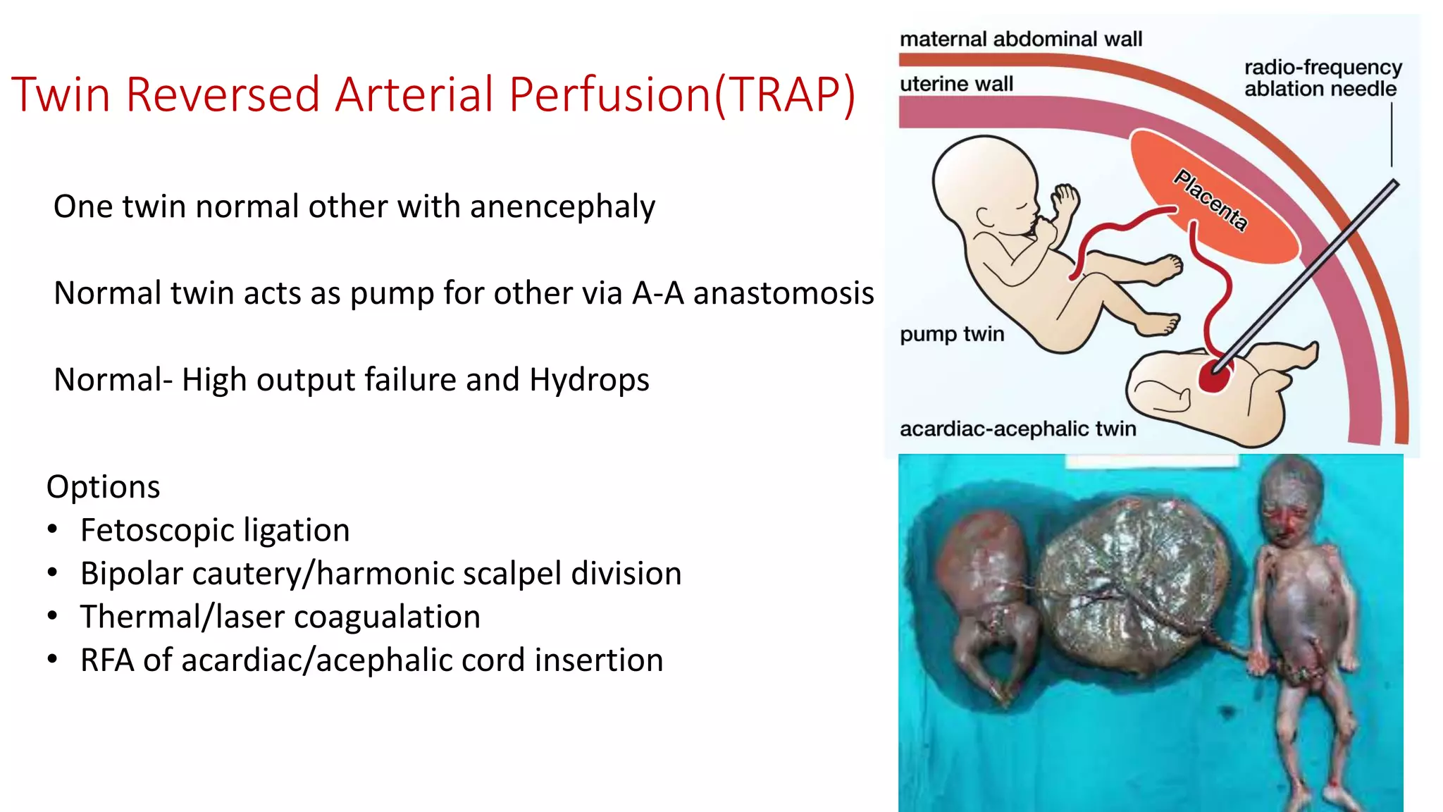 Fetal or Prenatal Surgery | PPTX