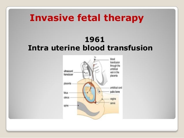 Fetal therapy