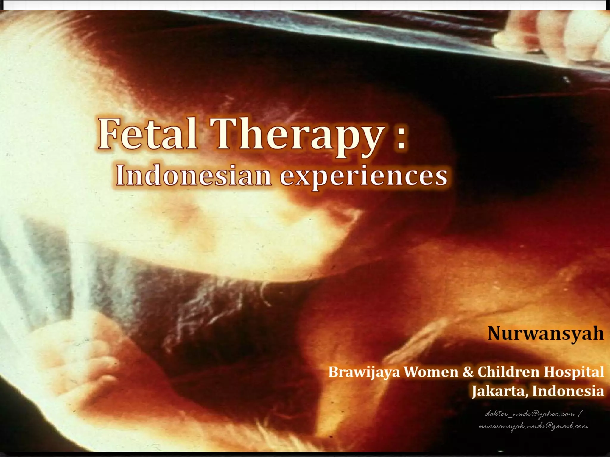 Fetal therapy indonesian experiences | PPT