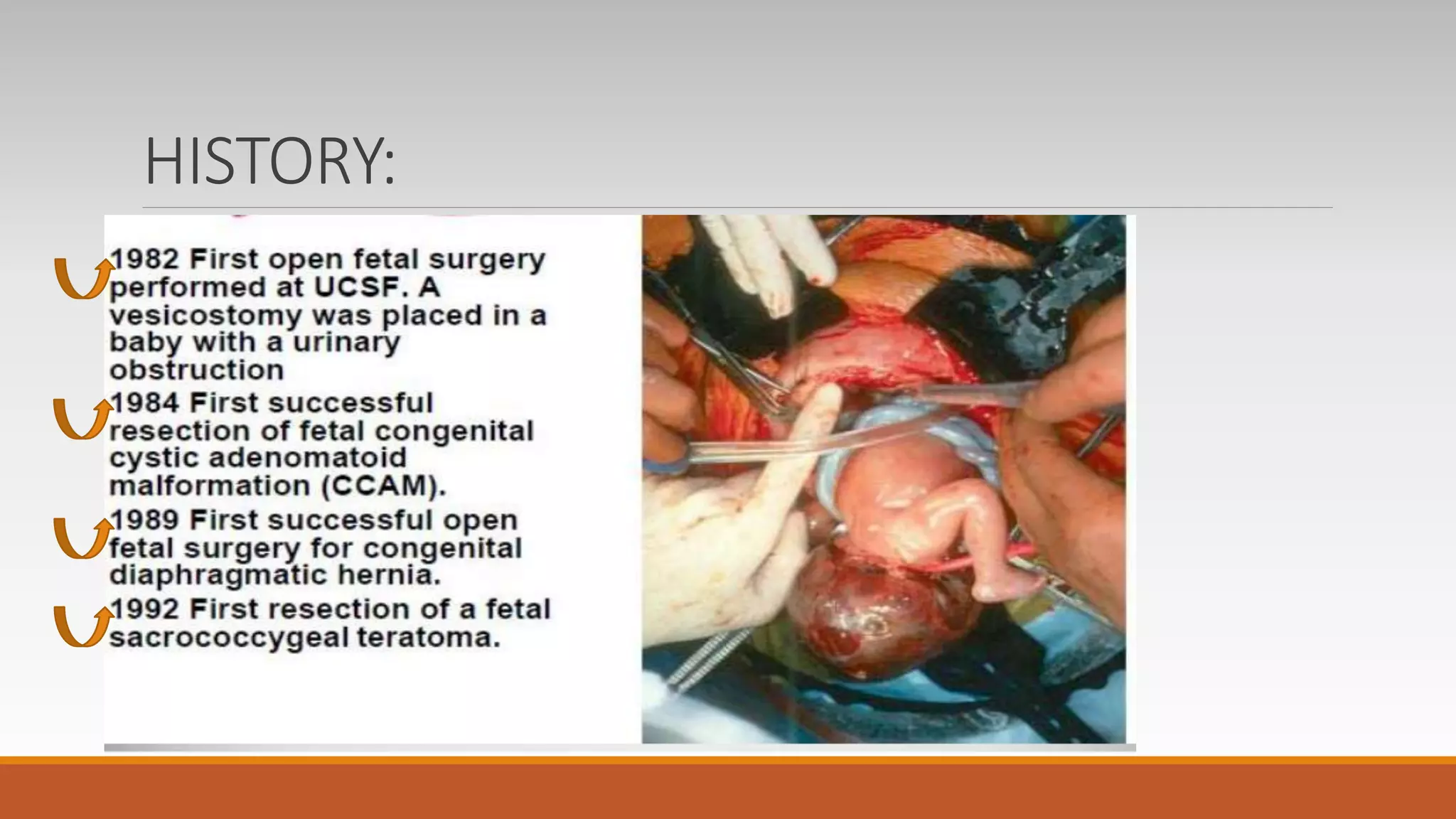 Fetal therapy - unborn patient (2019) | PPTX