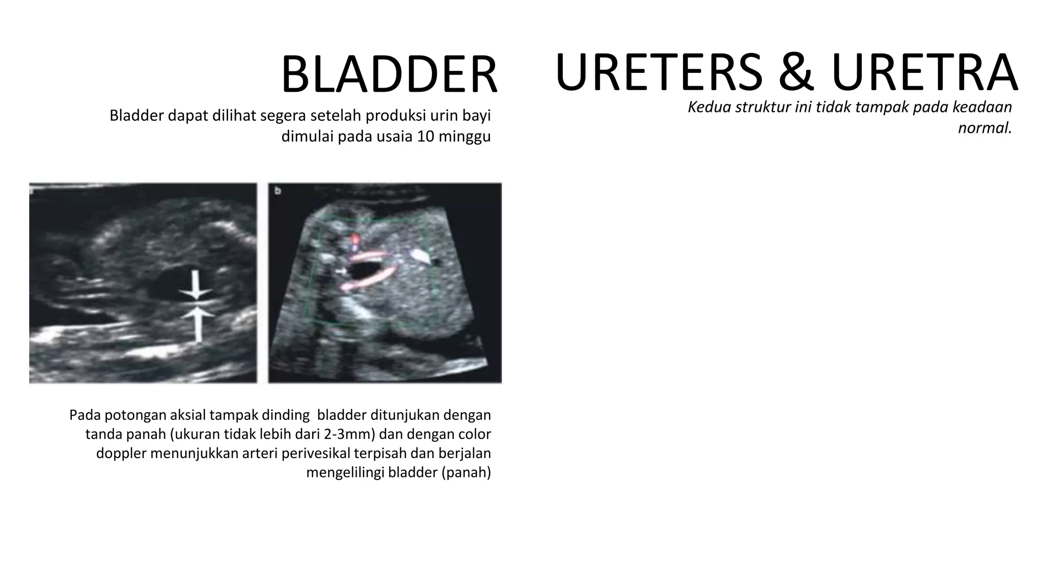 Fetal urinary tract ultrasound | PPTX