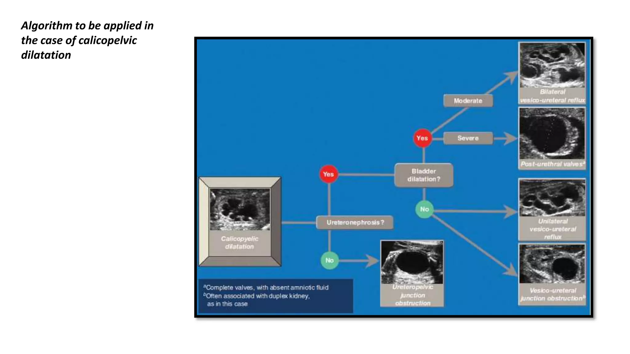Fetal urinary tract ultrasound | PPTX