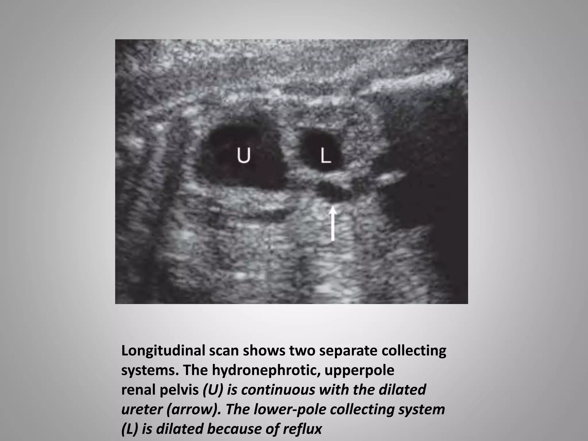 Fetal urogenital usg | PPTX