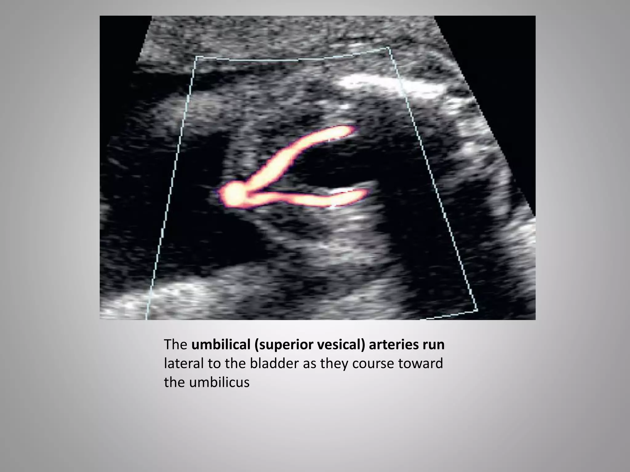 Fetal urogenital usg | PPTX