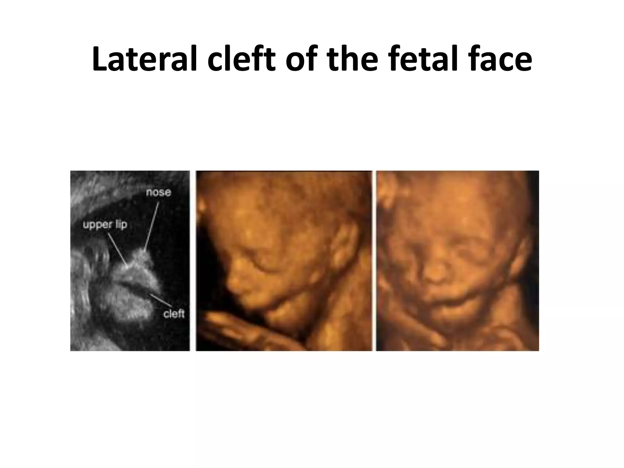 Fetal usg | PPTX
