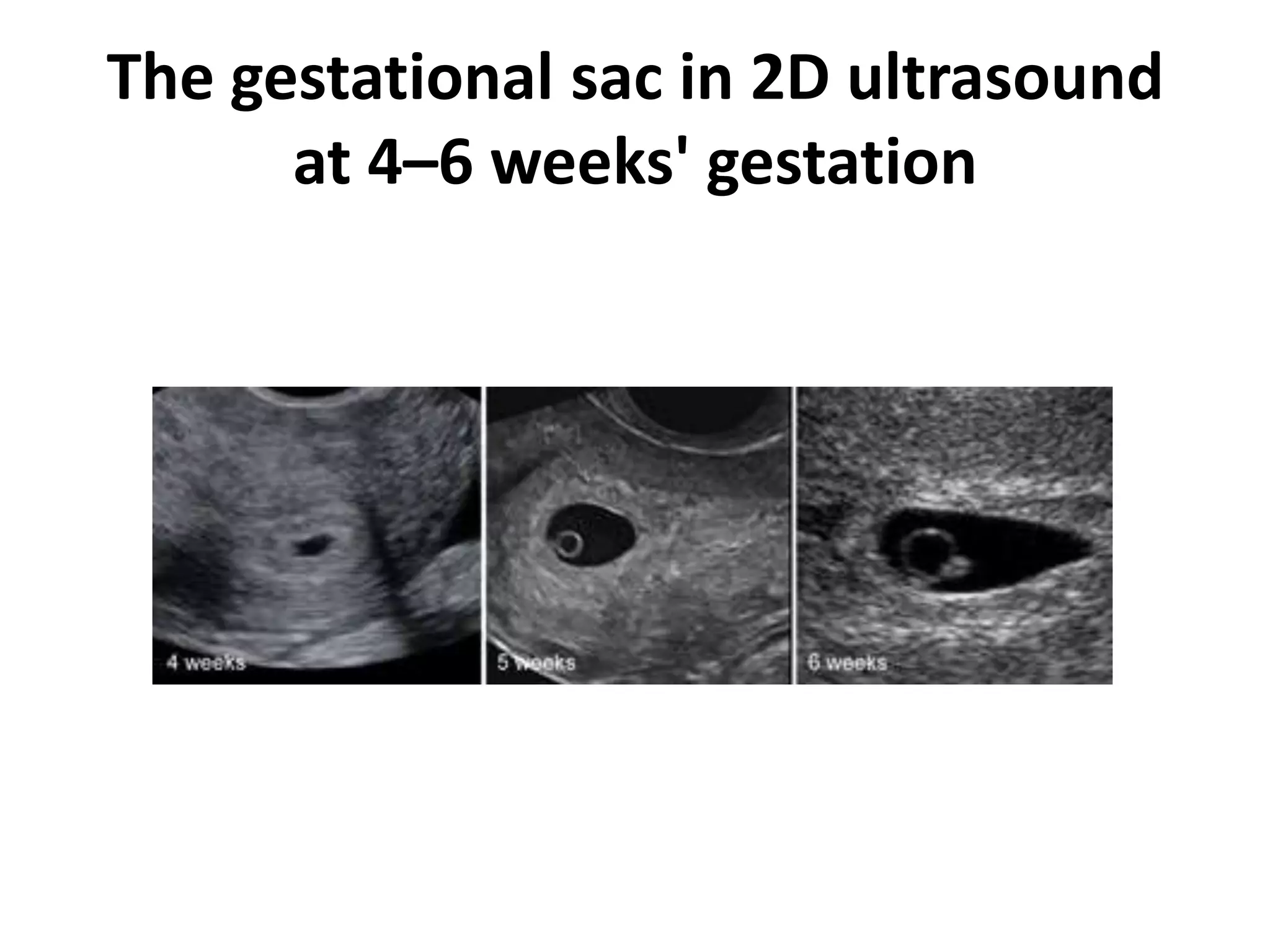 Fetal usg | PPTX