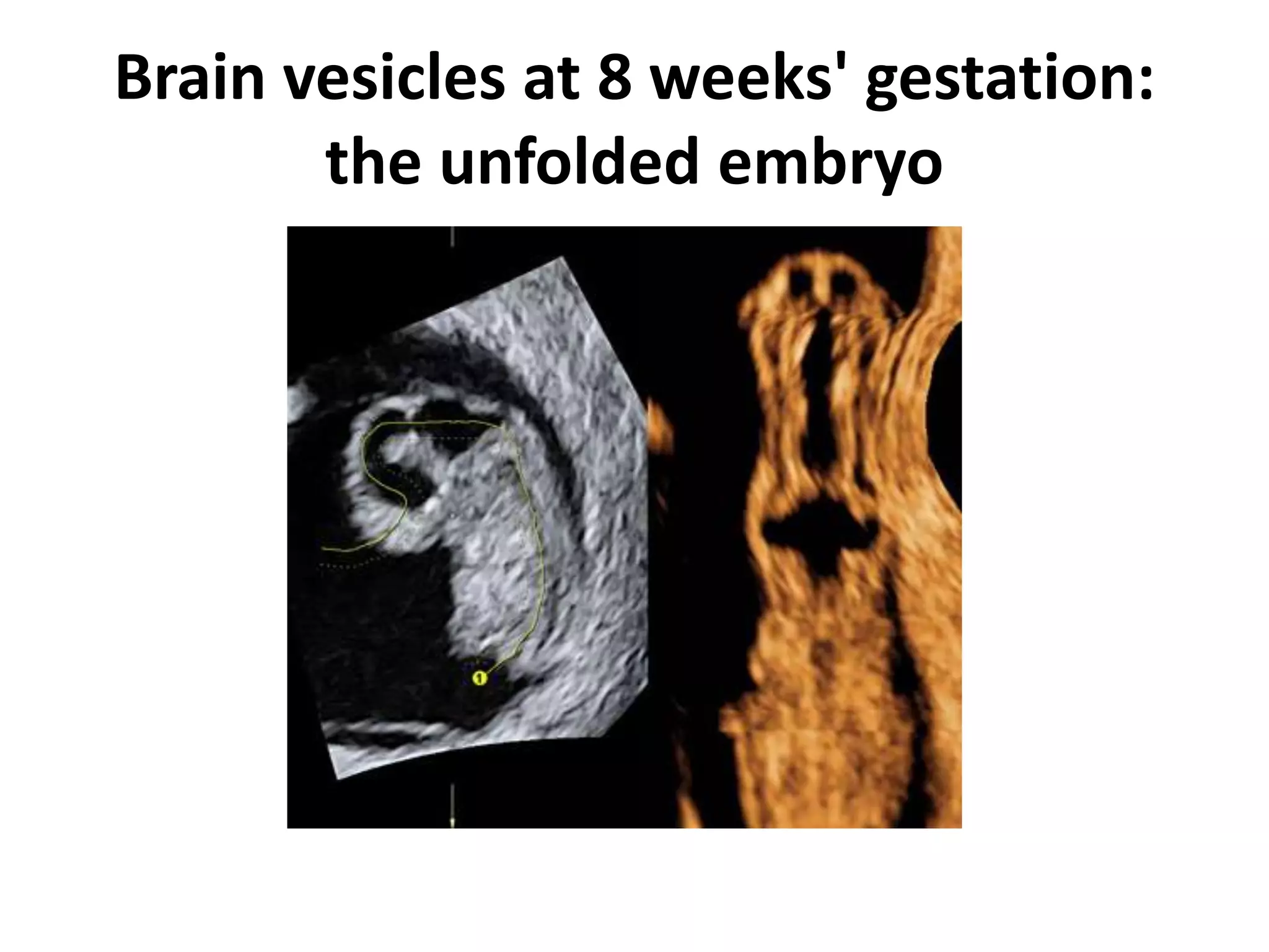 Fetal usg | PPTX