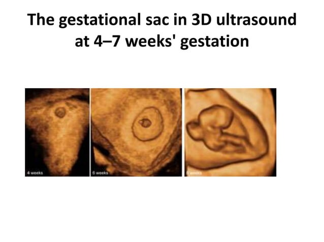 Fetal usg | PPTX