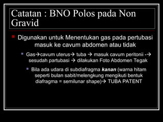 Teknik Radiografi untuk melihat Janin (Fetografi) | PPT