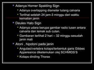 Teknik Radiografi untuk melihat Janin (Fetografi) | PPT