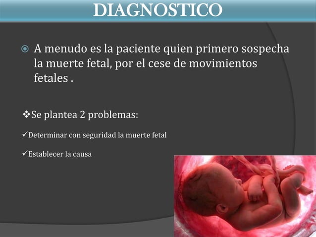 Feto muerto ppt | PPTX | Pregnancy | Reproductive Health