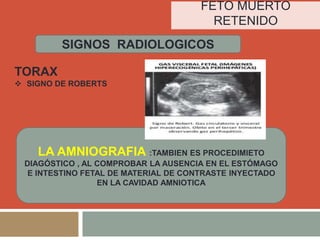 FETO MUERTO RETENIDO.pptx