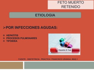 FETO MUERTO RETENIDO.pptx