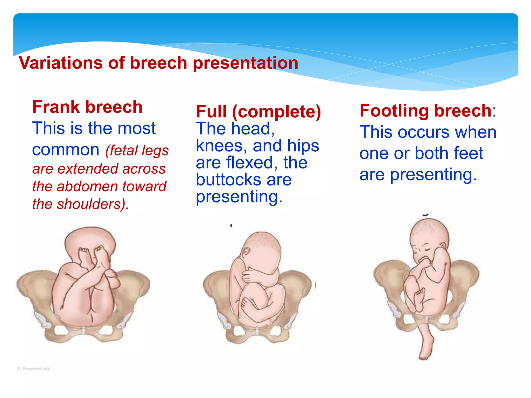 Fetopelvic relationship | PPTX