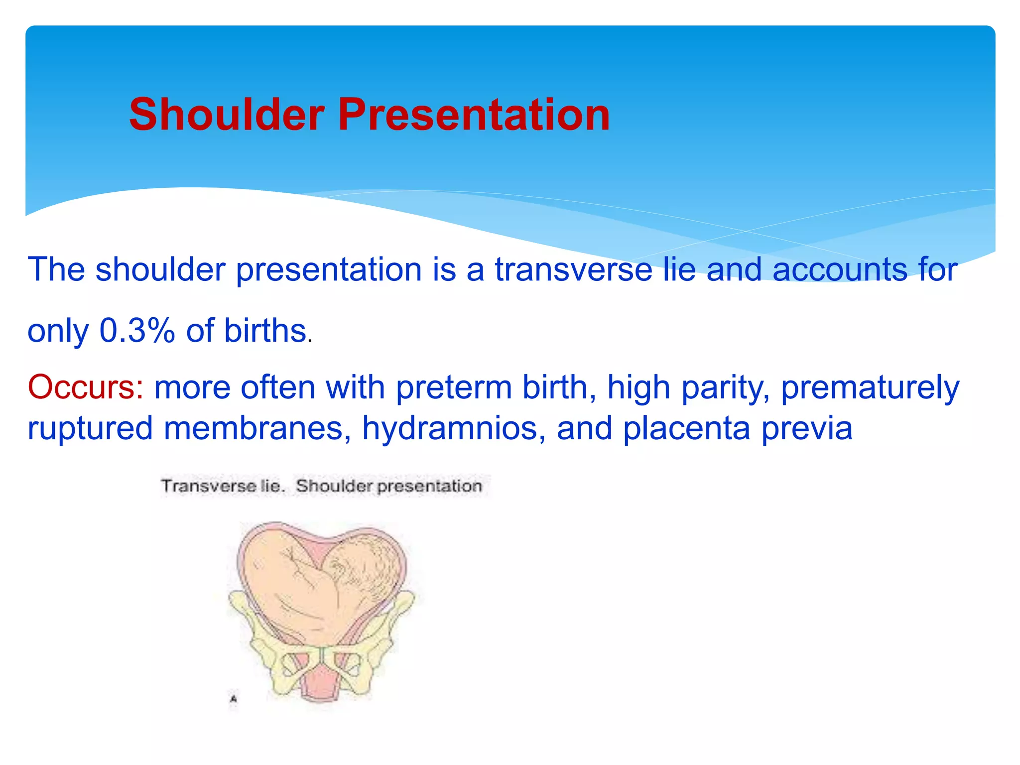 Fetopelvic relationship | PPTX