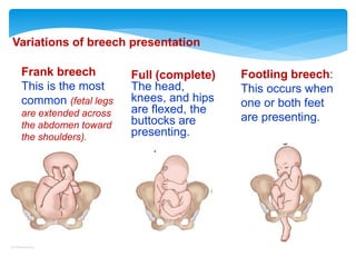 Fetopelvic relationship | PPTX