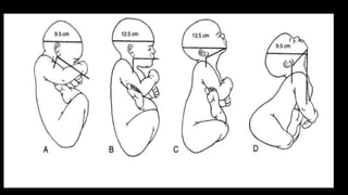 Fetopelvic relationship final presentation.pptx