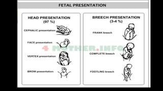 Fetopelvic relationship final presentation.pptx