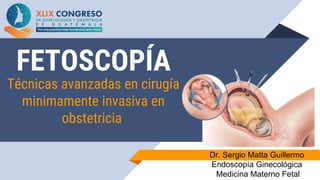 Fetoscopía.pptx