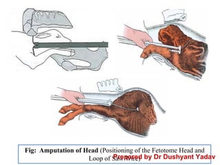 Fetotomy in bovines by Dr Dushyant Yadav BASU, Patna INDIA | PPT