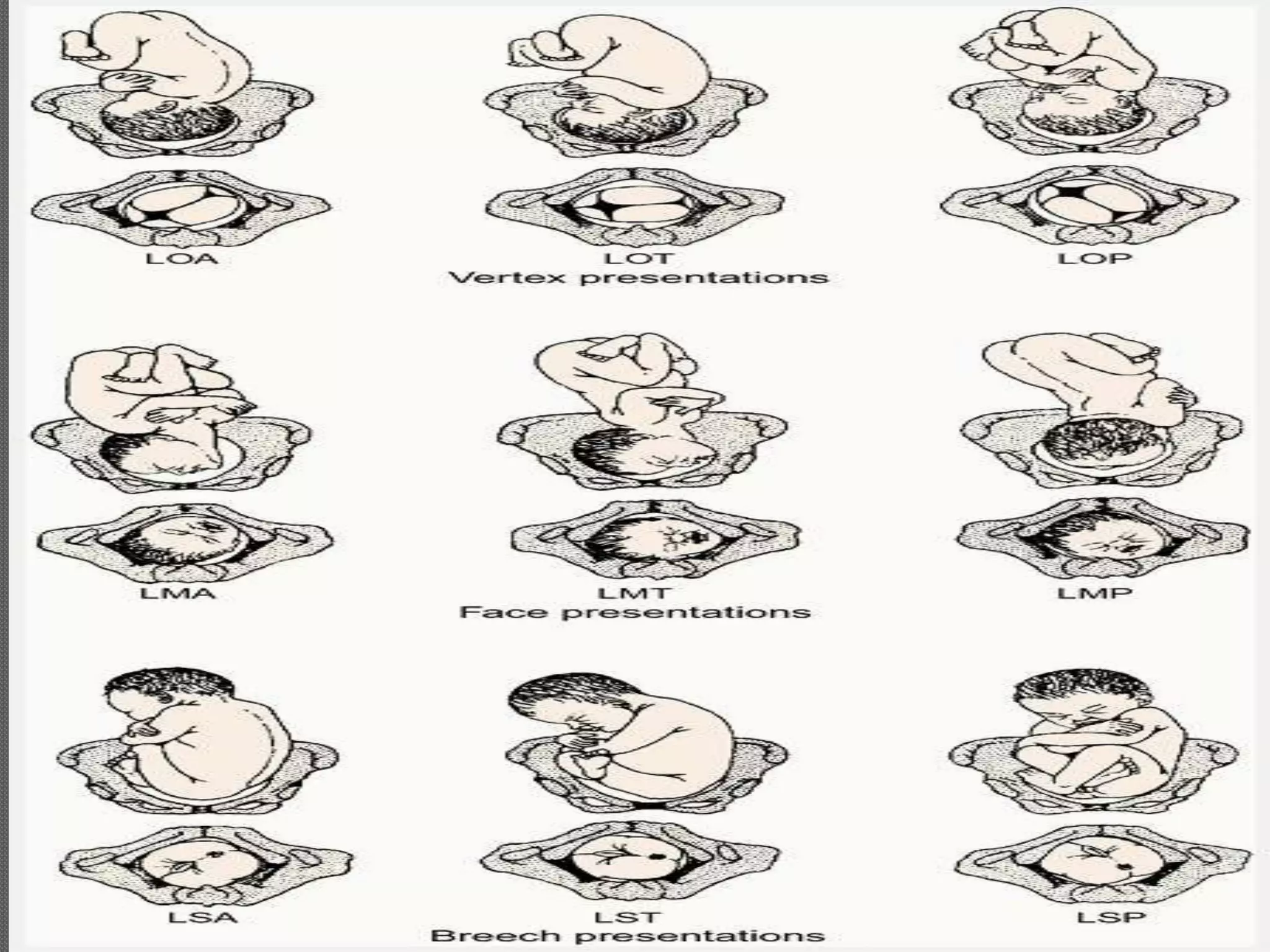 Fetus in utero | PPTX