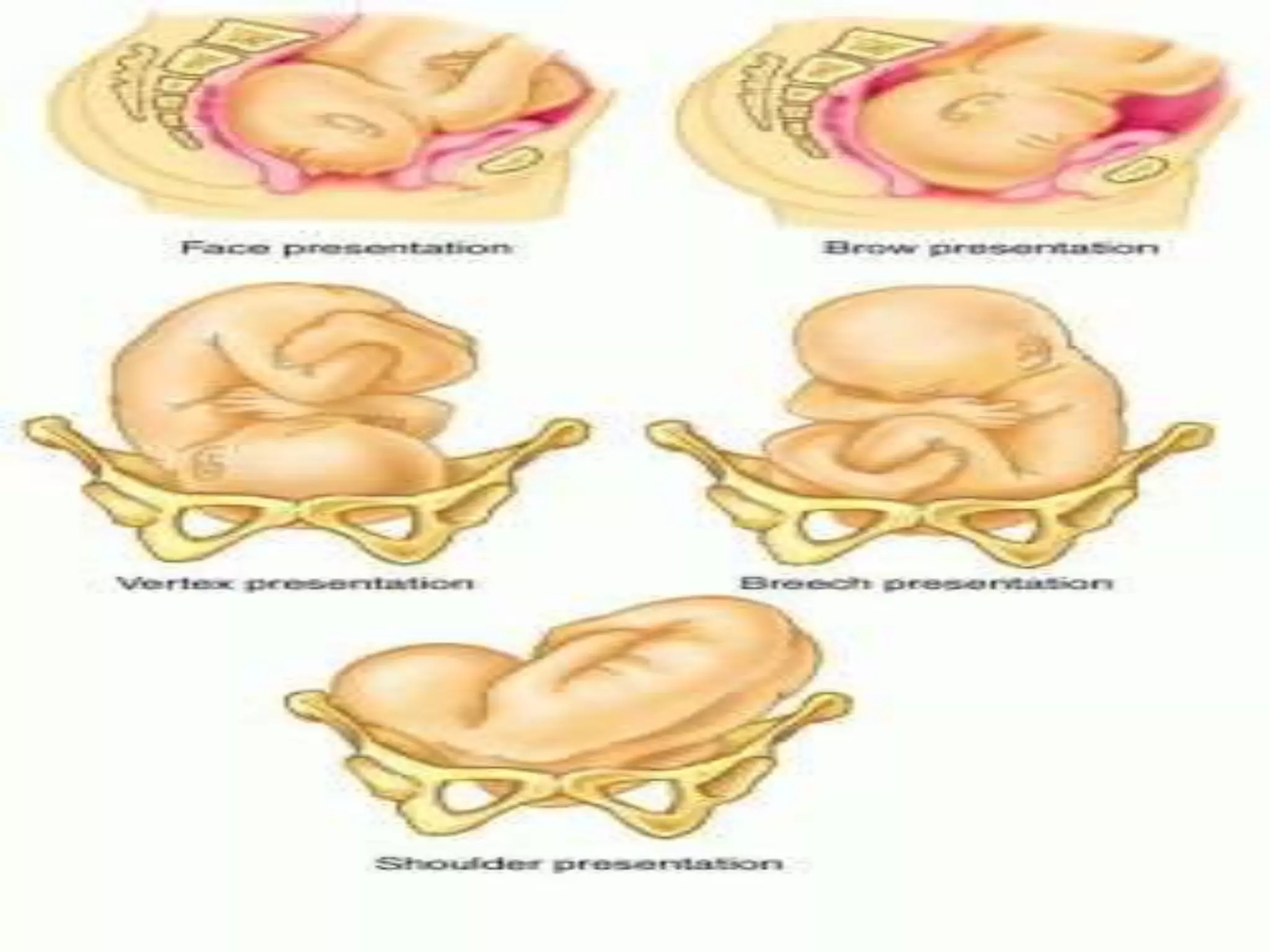 Fetus in utero | PPTX