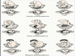 Fetus in utero | PPTX