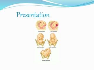 Fetus in utero | PPTX